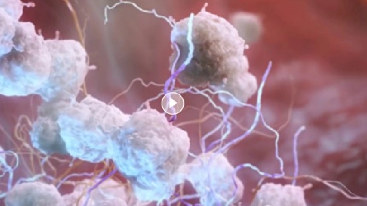 How CABLIVI Works Video | CABLIVI (caplacizumab-yhdp)